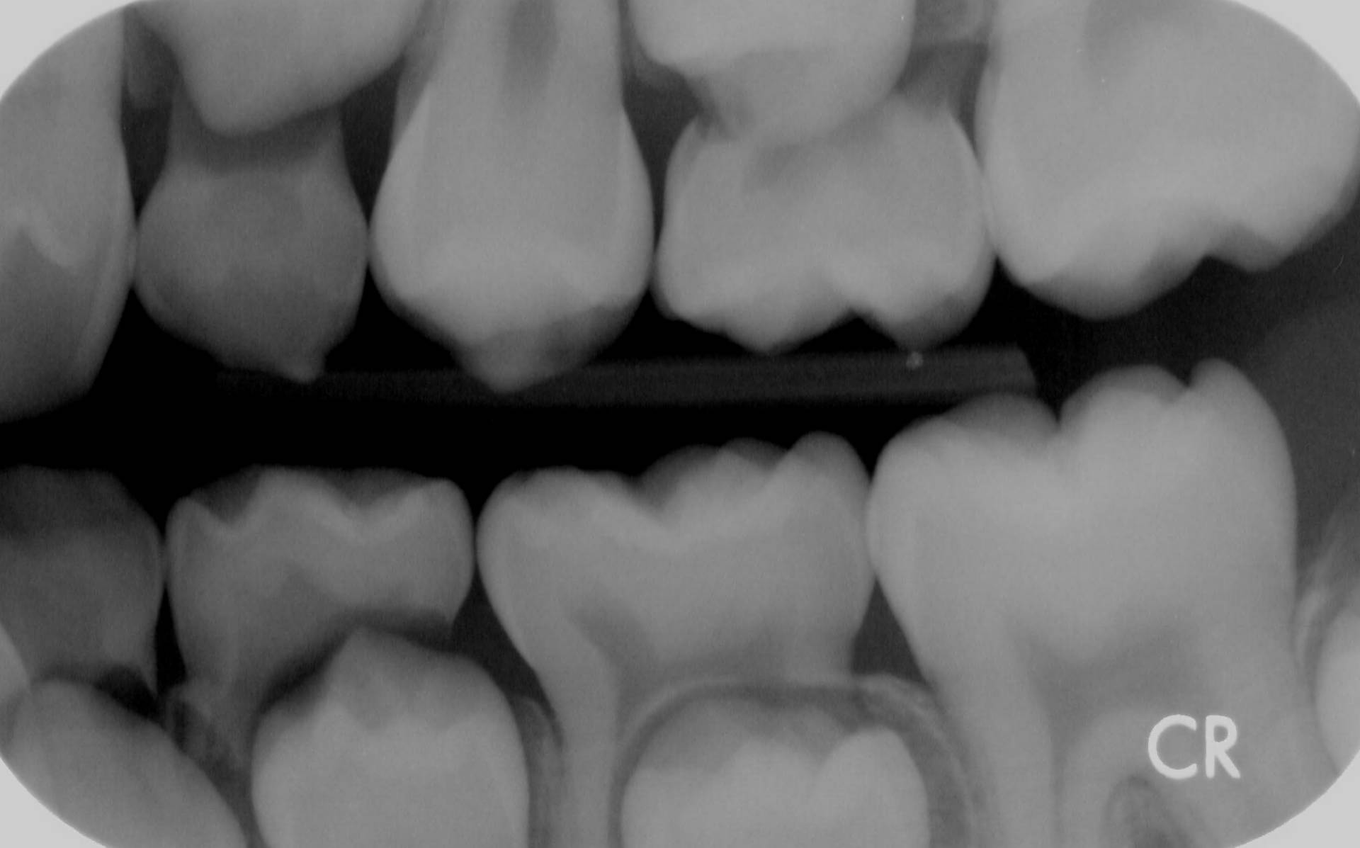 Services | Digital X-Ray | Pacific Pediatric Dental Centre